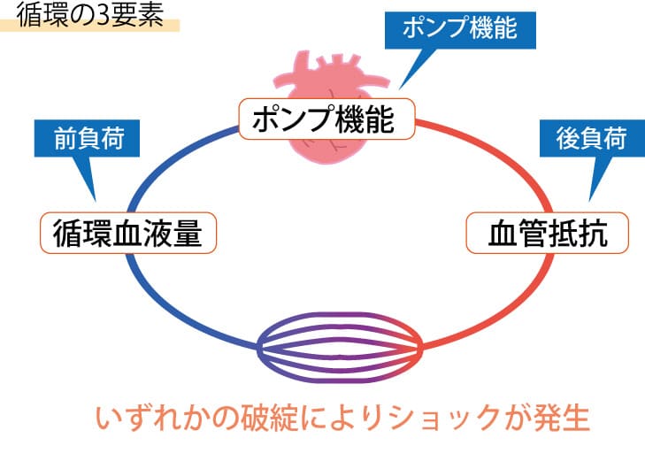 ショックの4つの分類と初期対応