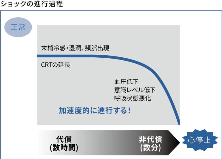 ショックの4つの分類と初期対応